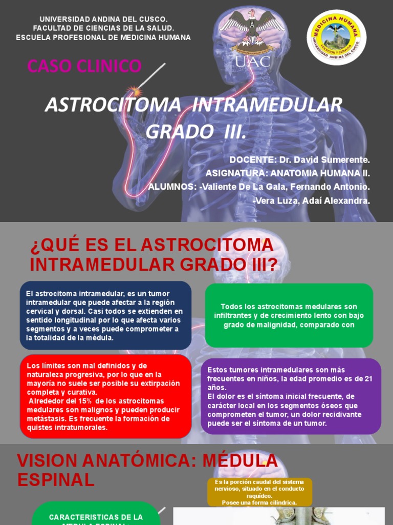 Astrocitoma | PDF | Médula espinal | Sistema nervioso