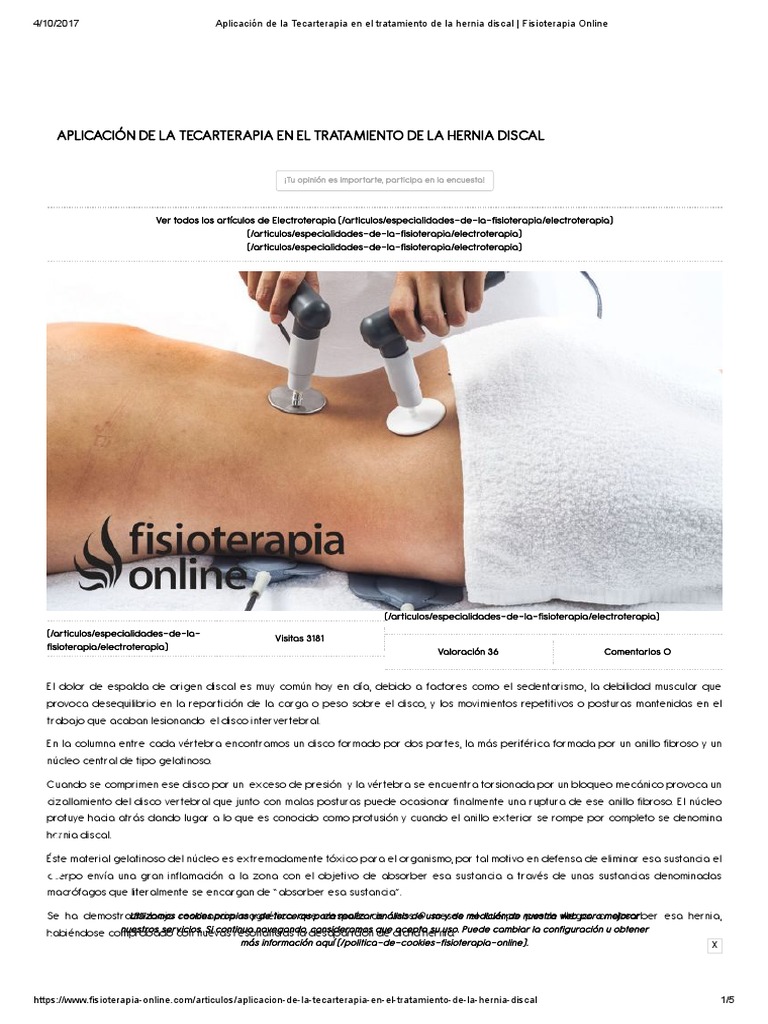 Aplicación de La Tecarterapia en El Tratamiento de La Hernia Discal ...