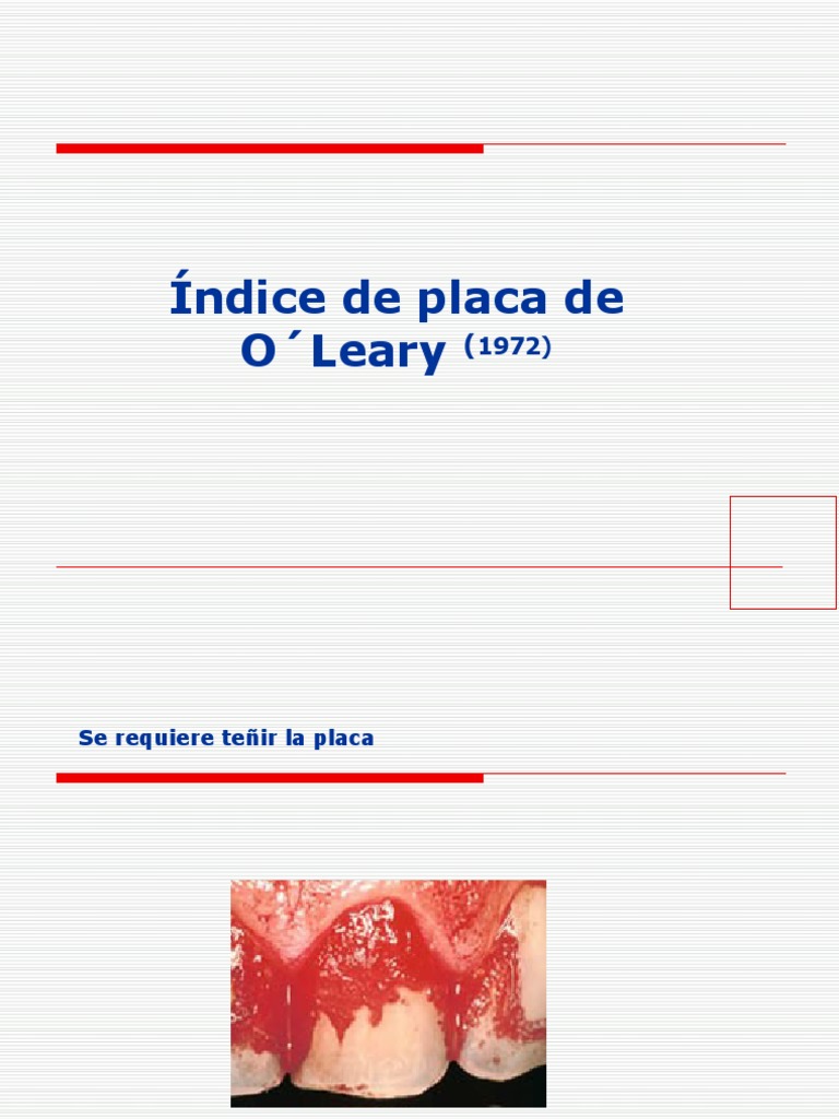 Índice de Placa de O'Leary: Procedimiento y Cálculo | PDF | Odontología ...