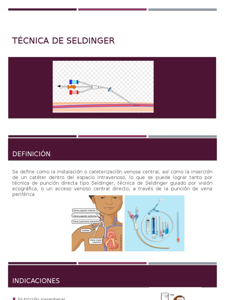 Tecnica de Seldinger | PDF | Tratamientos médicos | Enfermedades y ...