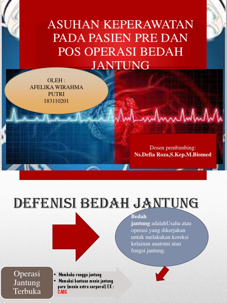AFELIKA WIRAHMA PUTRI 2B PPT Askep Pre Post Bedah Jantung-Converted-Compressed PDF | PDF