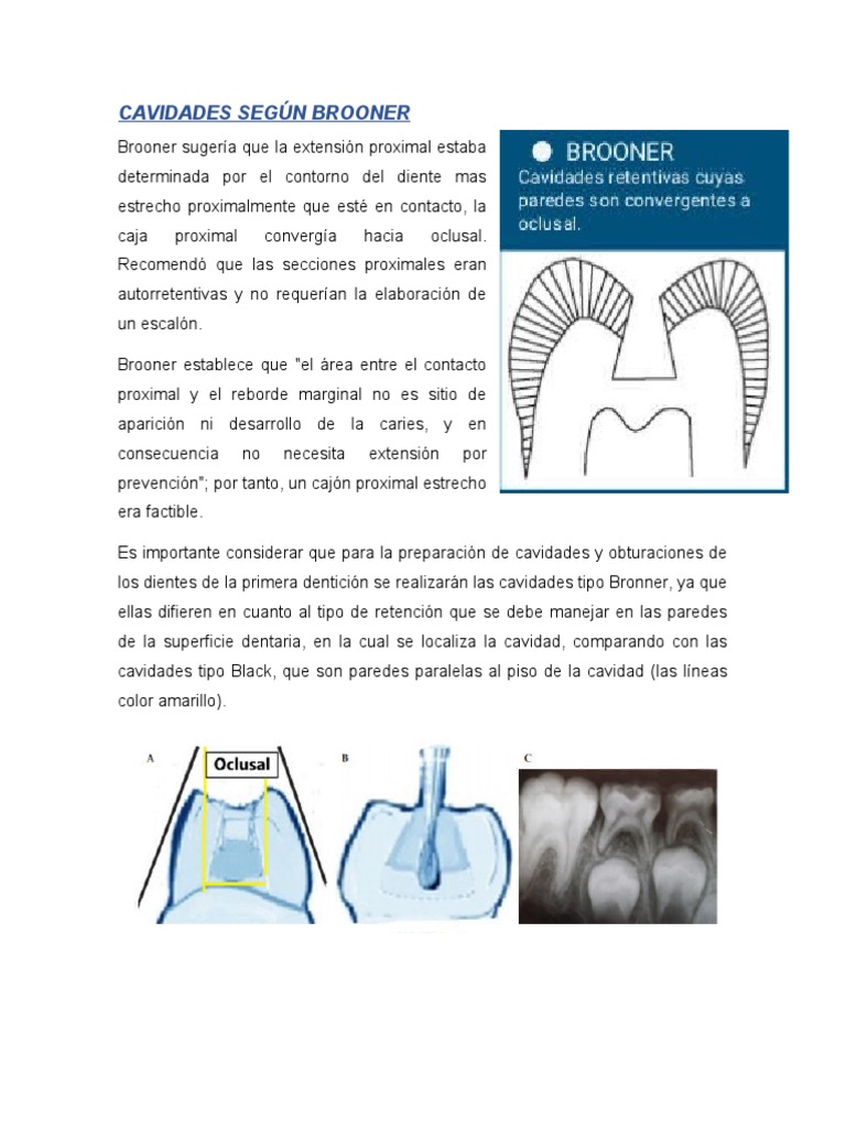 Cavidades Según Brooner | PDF | Diente | Naturaleza