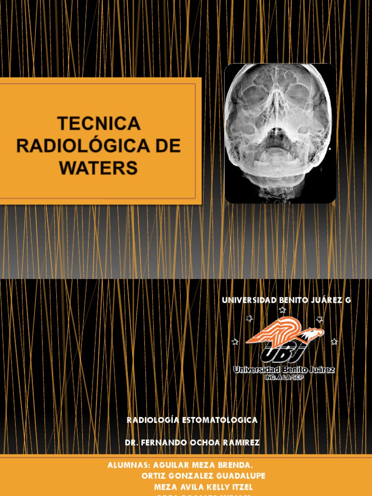 Exposición de Waters | PDF | Cabeza y cuello humanos | Anatomía humana