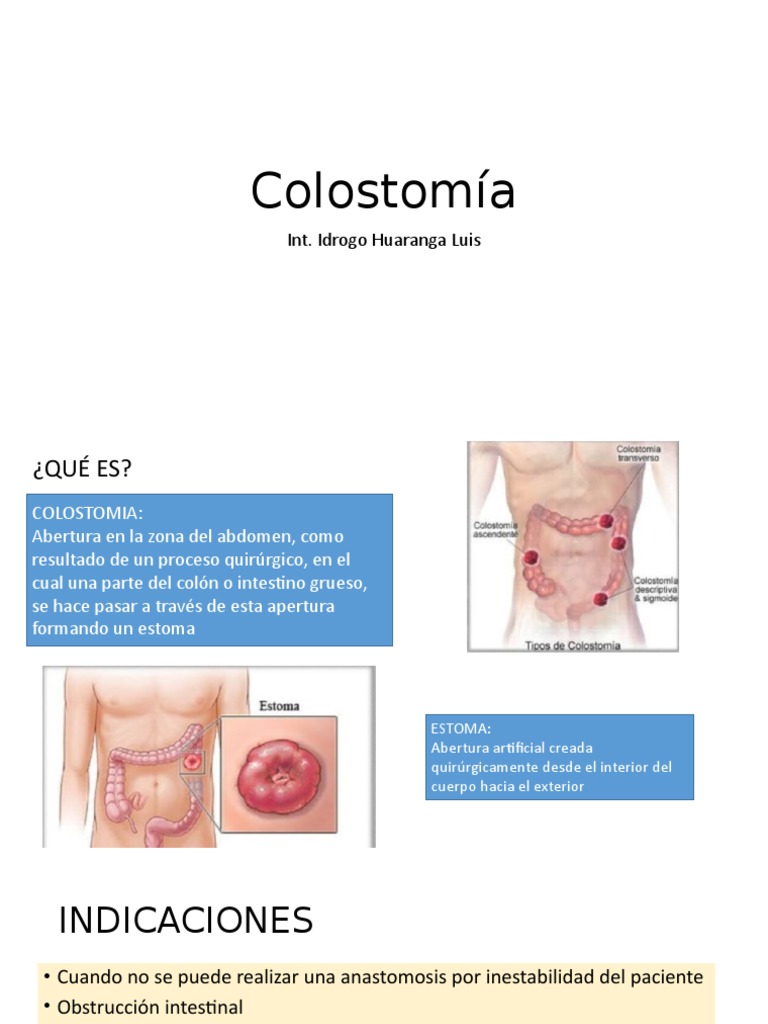 Ileostomía Vs Colostomía