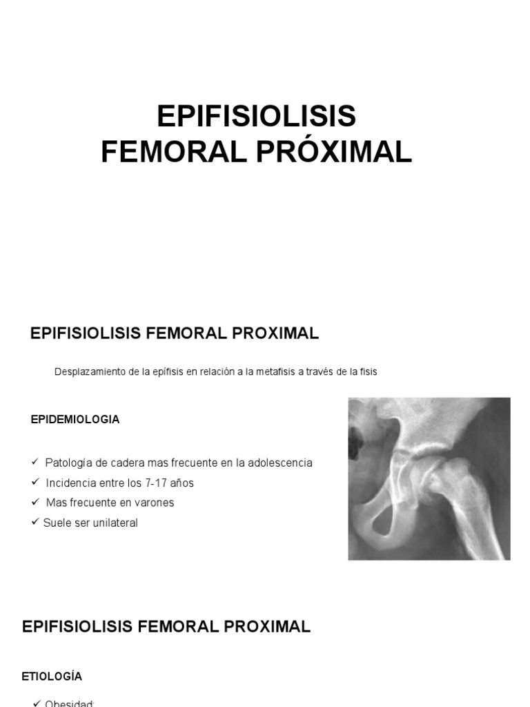 Epifisiolisis Femoral Proximal | PDF | Rodilla | Medicina CLINICA