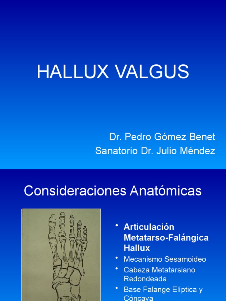 Angulos Y Tratamientos Del Hallux Valgus Pdf Dedo Del Pie Pie