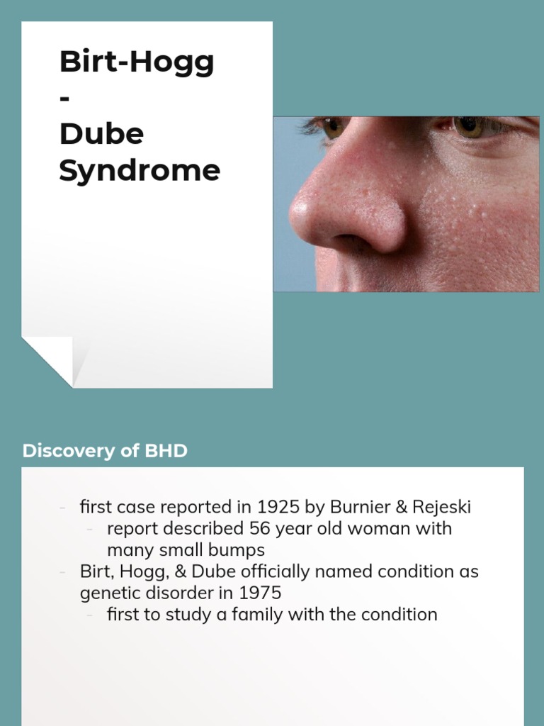Birt-Hogg-Dube Syndrome PDF | PDF | Genetics | Clinical Medicine