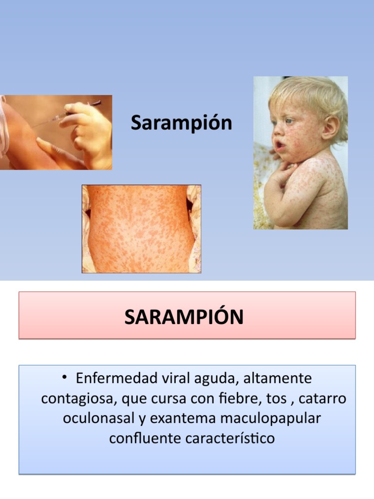 SARAMPION | PDF | Sarampión | Microbiología
