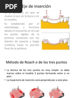 Clasificacion de Vertucci | PDF | Diente | Anatomia dental