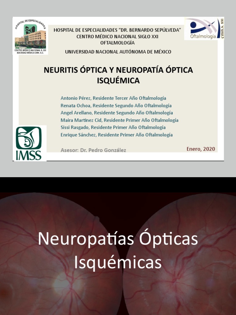 Neuropatia Optica | PDF | Enfermedad de Lyme | Enfermedades y trastornos