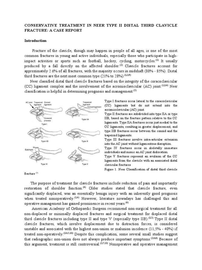 Conservative Treatment in Neer Type Ii Distal Third Clavicle Fracture ...