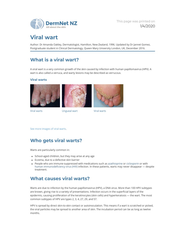 Viral Wart - DermNet NZ | PDF | Dermatology | Virus