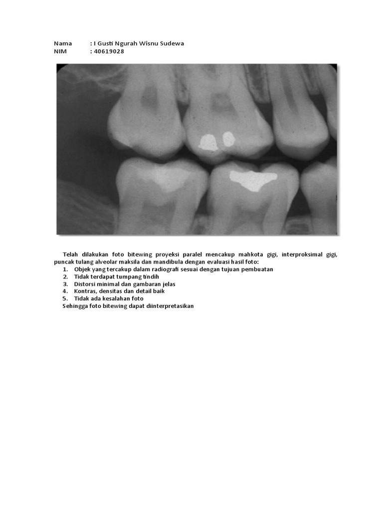 Interpretasi Radiografi Bitewing Gigi | PDF