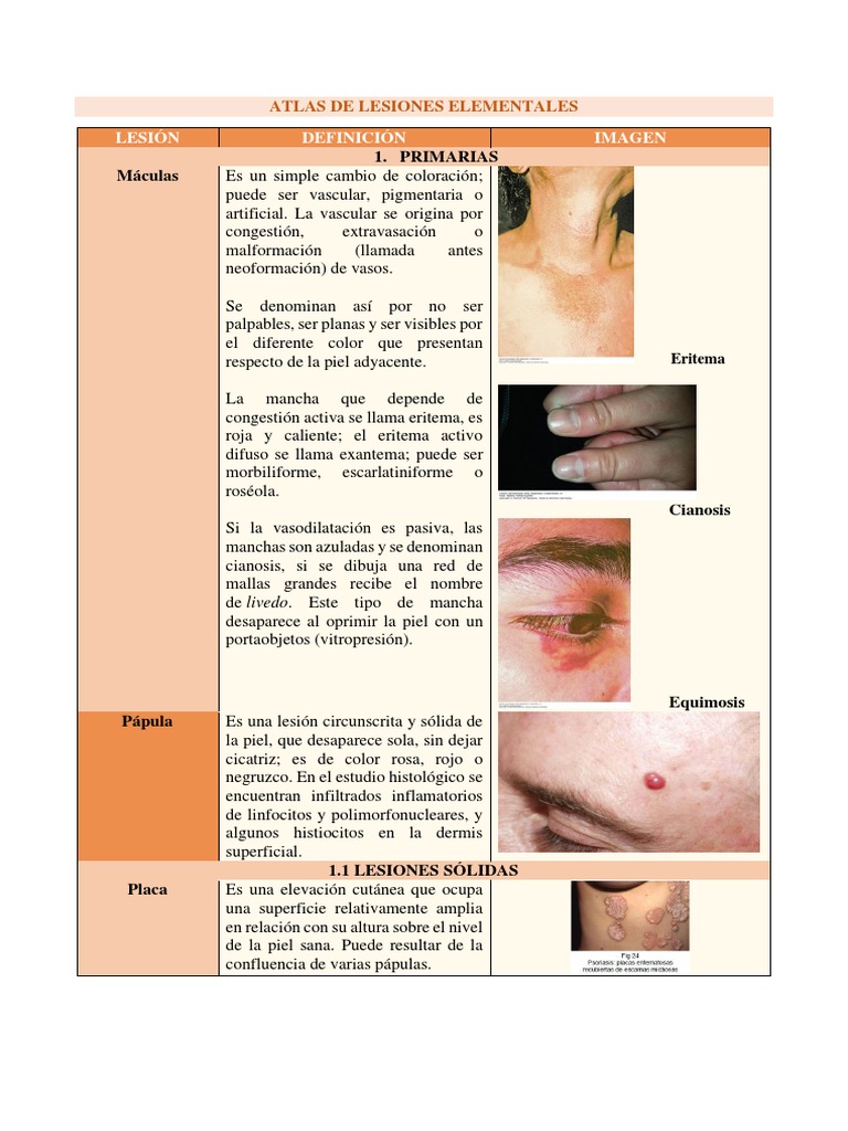 Atlas de Lesiones Elementales | PDF | Piel | Epidermis