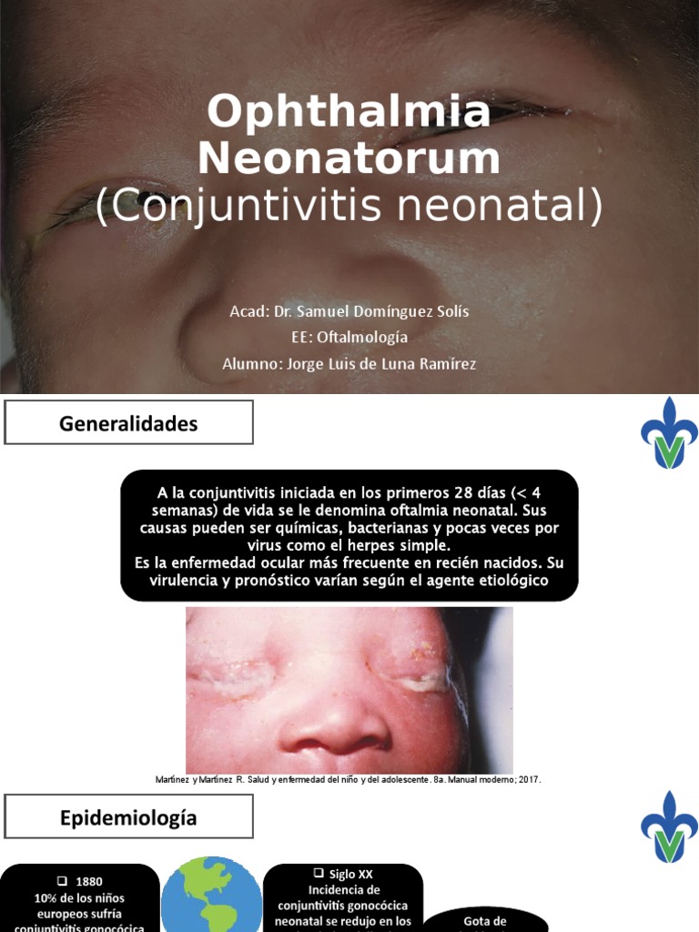 Conjuntivitis Neonatal Oftalmo | PDF | Rtt | Especialidades Medicas