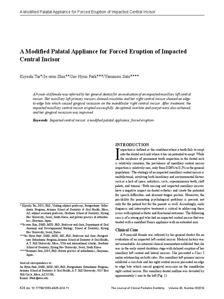 A Modified Palatal Appliance For Forced Eruption of Impacted Central ...