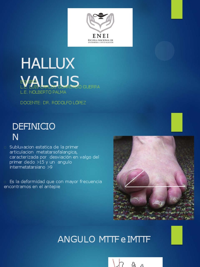 Hallux Valgus | PDF | Sistema esquelético | Anatomía del miembro inferior