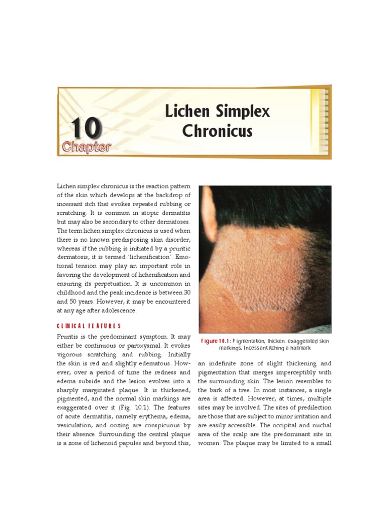 Lichen Simplex Chronicus | PDF | Dermatitis | Cutaneous Conditions