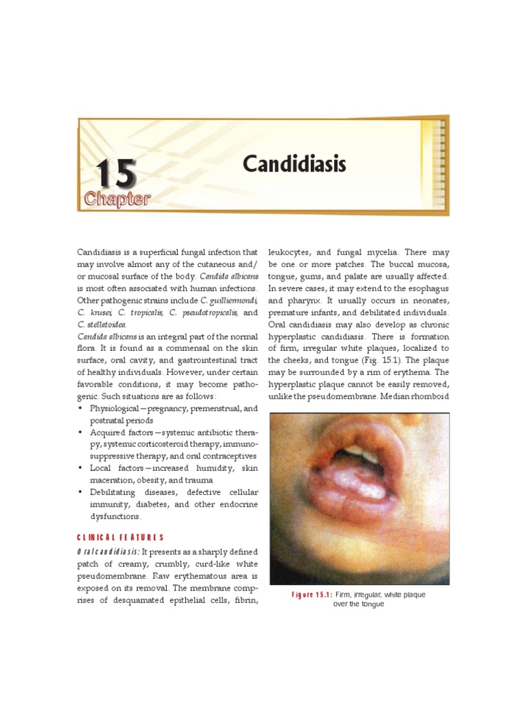 Candidiasis: Clinical Features | PDF | Candidiasis | Dermatology