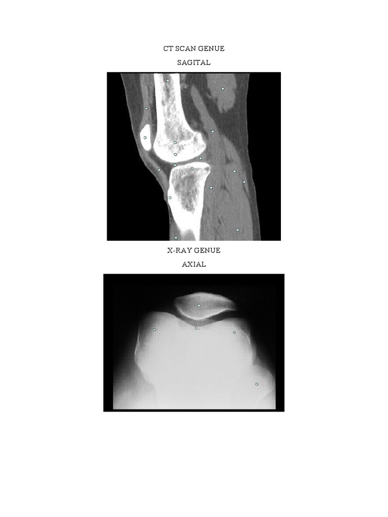 CT Scan Genue | PDF