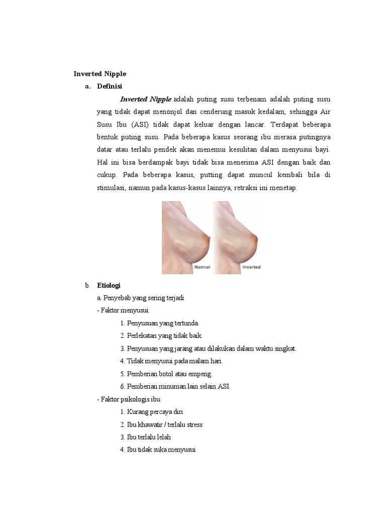 Inverted Nipple | PDF