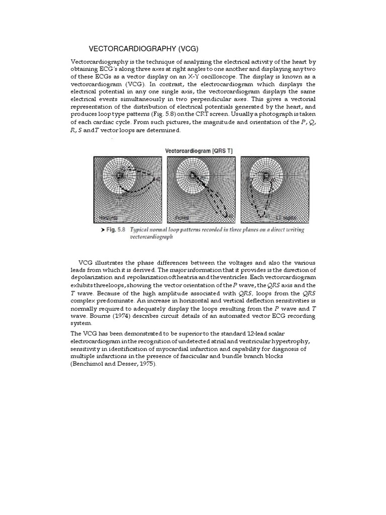 Vectorcardiography (VCG) : R, S Andt Vector Loops Are Determined | PDF