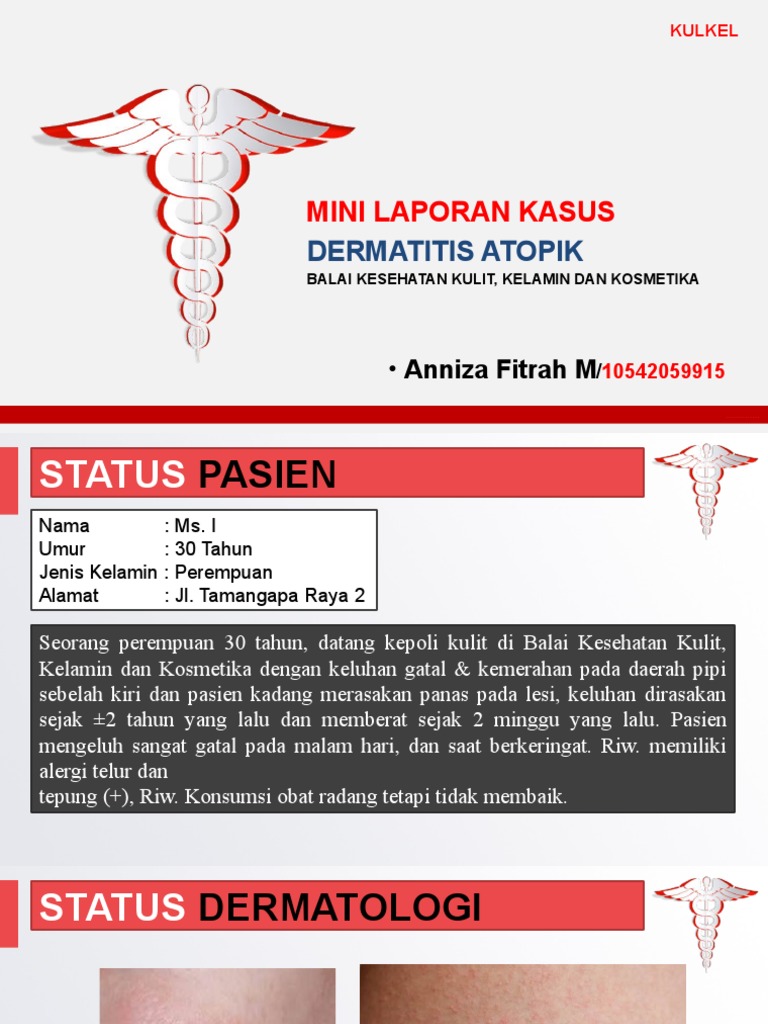 Dermatitis Atopik. Mini Lapsus | PDF