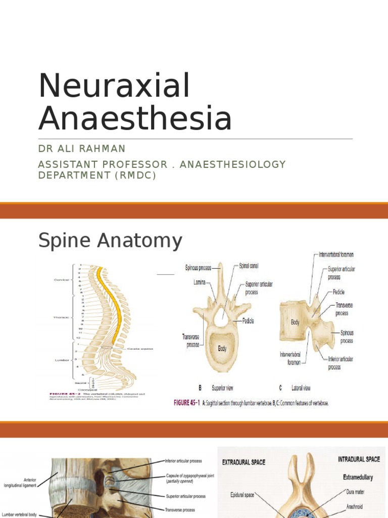 Neuraxial Anaesthesia: DR Ali Rahman Assistant Professor ...