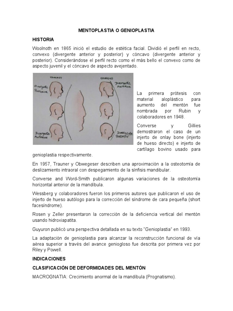 Técnicas de Mentoplastia y Genioplastia | PDF | Especialidades Medicas ...