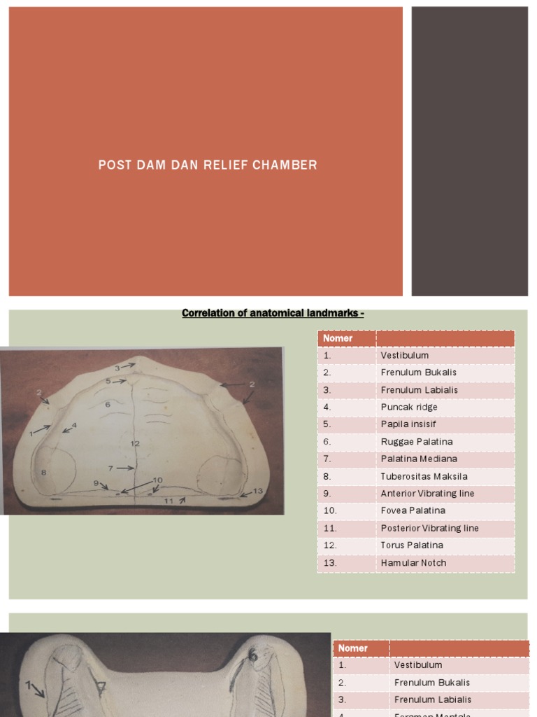 Post Dam-1.pptx - PPTX 2 | PDF