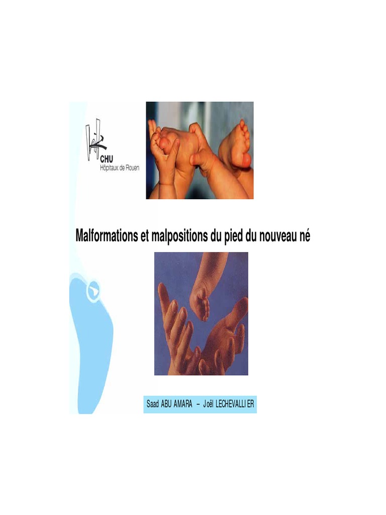 Malpositions et malformations du pied | PDF | Pied | Appareil locomoteur