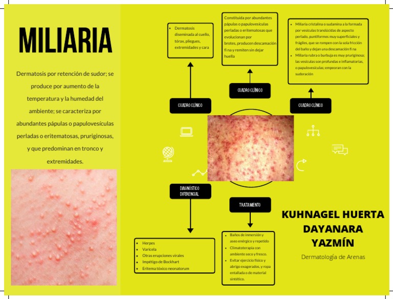 Miliaria | PDF | Dermatología | Condiciones cutáneas
