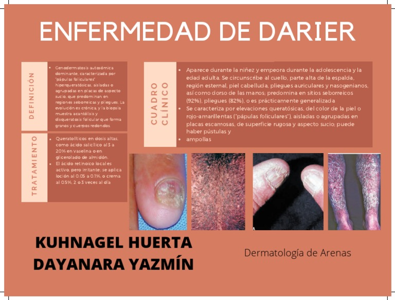 Enfermedad de Darier | PDF