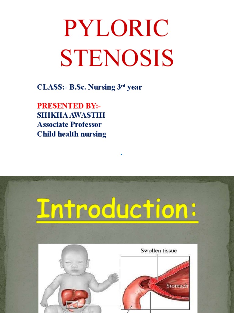 Postoperative Care for Pyloric Stenosis | PDF | Organ (Anatomy ...