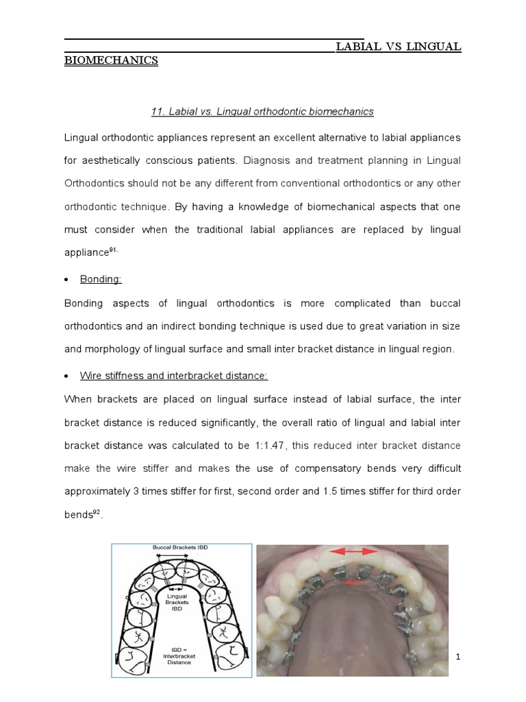 Labial vs Lingual Orthodontics Biomechanics | PDF | Orthodontics ...