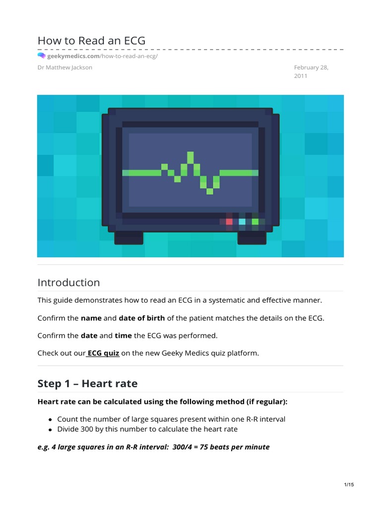 How To Read An ECG | PDF | Electrocardiography | Heart Rate