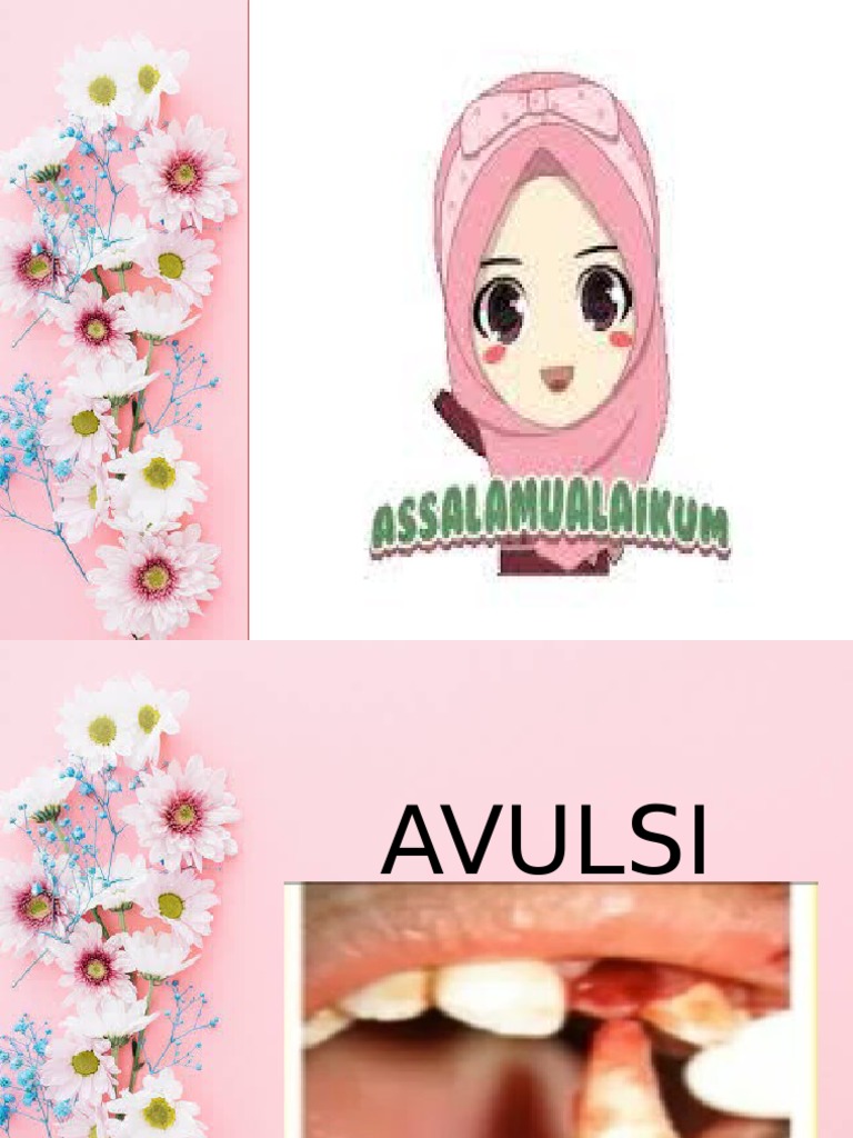 Avulsi Gigi | PDF