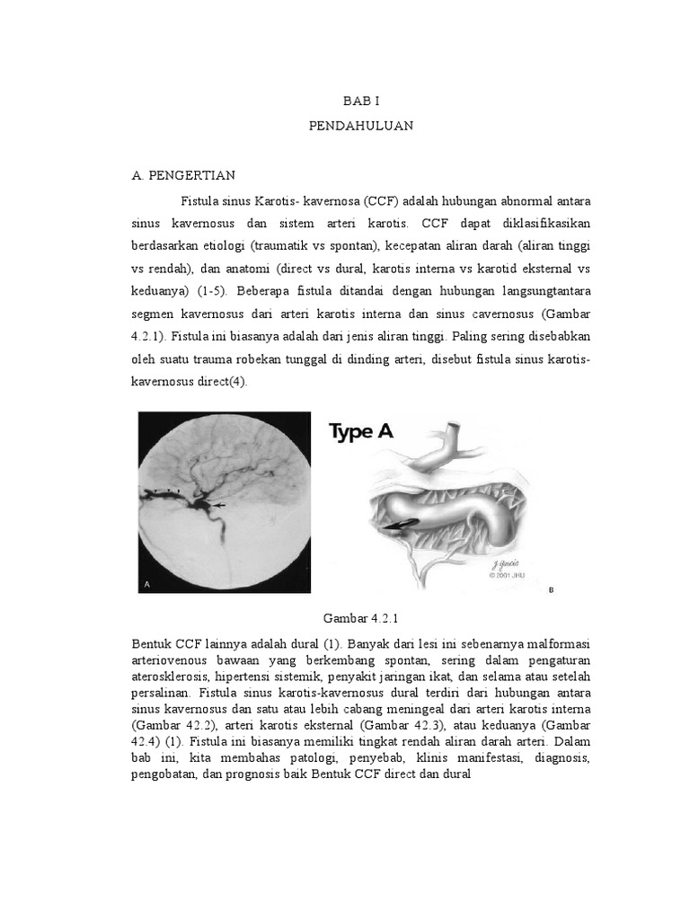 Fistula Sinus Karotis-Kavernosus: CCF | PDF