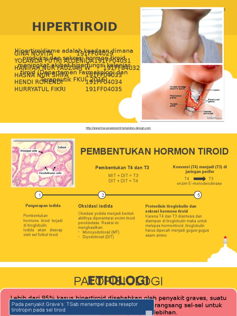 5 Hipertiroid | PDF