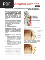 Basic FESS - Step-By-Step Guide With Surgical Videos PDF | PDF | Human ...