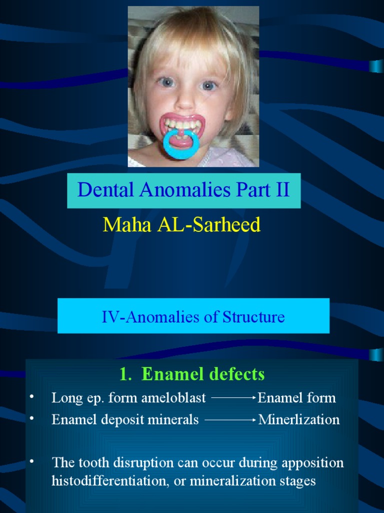 Dental Anomalies Part II | PDF