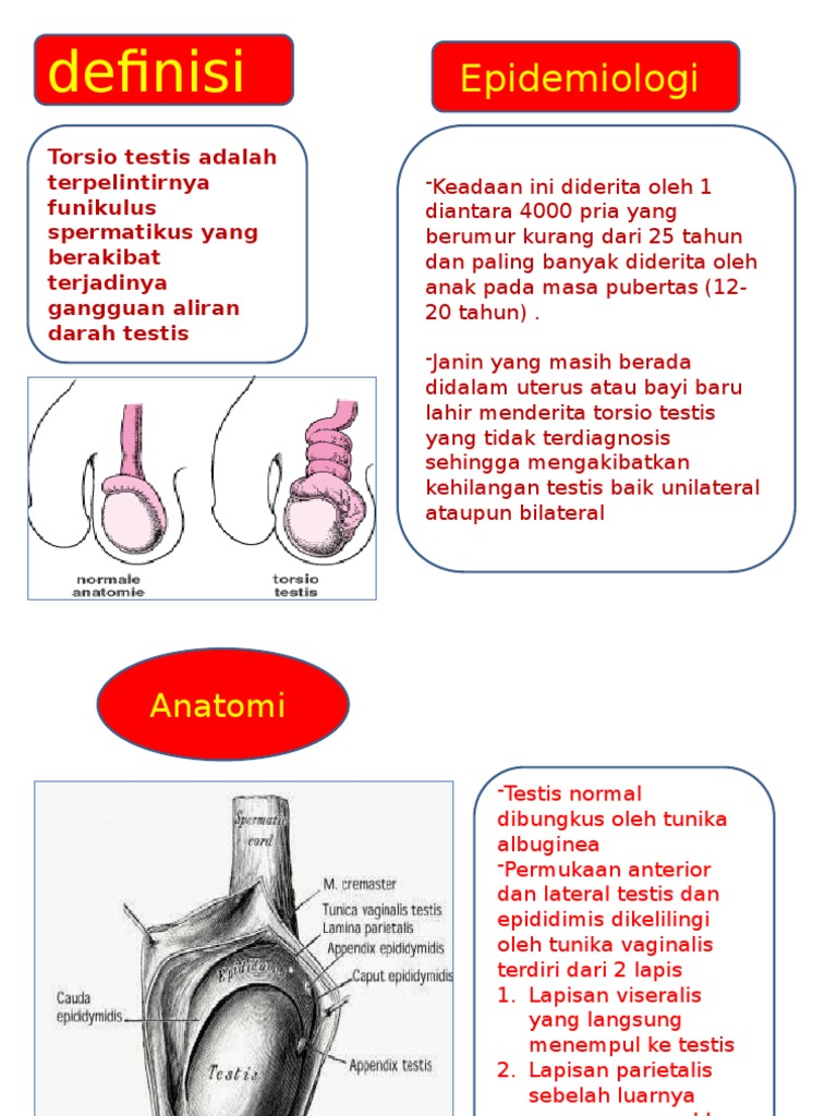 Torsio Testis | PDF