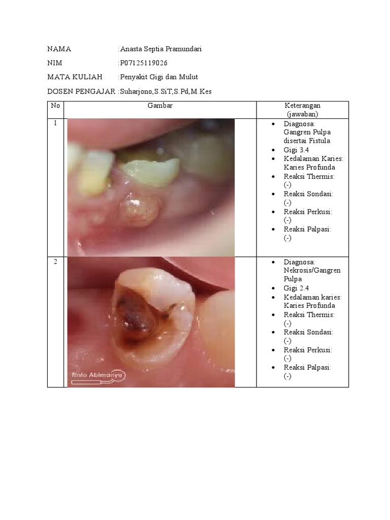 Ulcus Decubitus | PDF