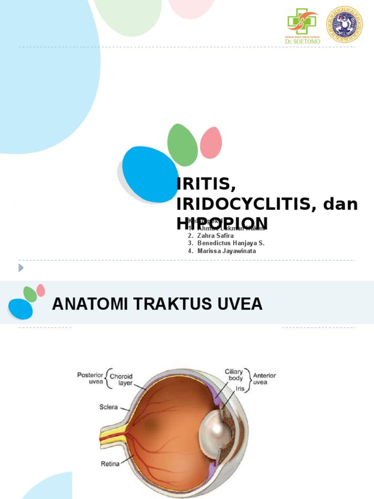 Uveitis Anterior Dan Hipopion | PDF