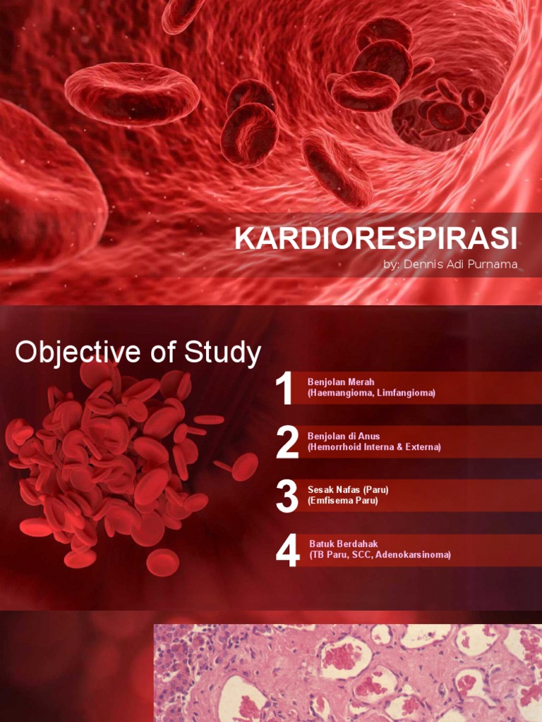 Kardiorespirasi: By: Dennis Adi Purnama | PDF