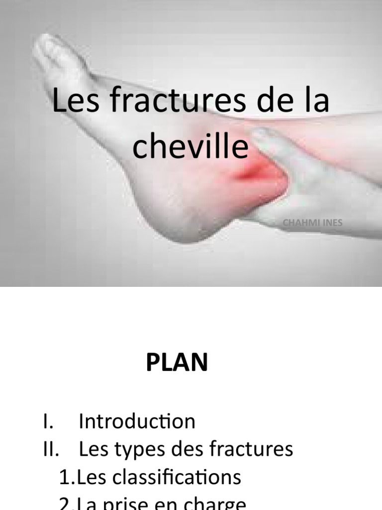 Les Fractures de La Cheville | PDF | Orthopédie | Trouble ...