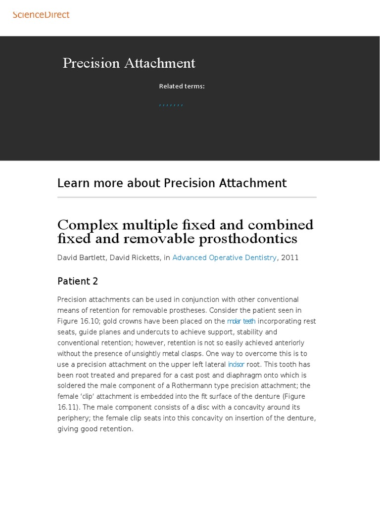 Precision Attachment: Complex Multiple Fixed and Combined Fixed and ...