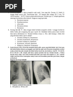 Interpretasi Spirometri | PDF