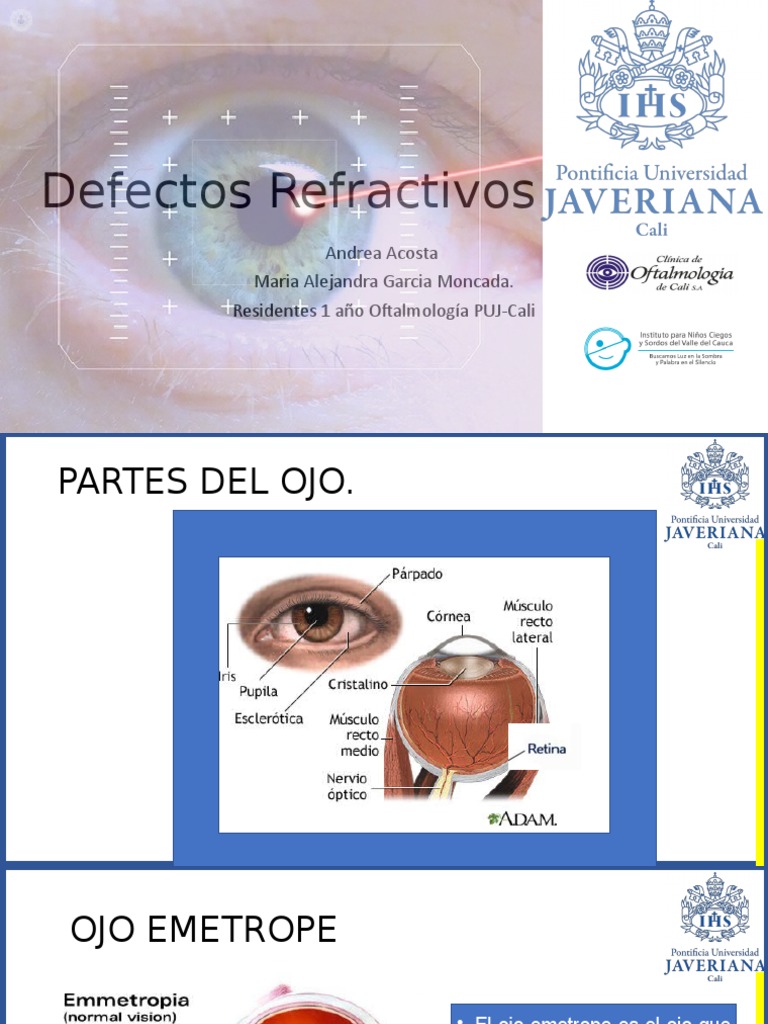 Defectos Refractivos Exposalud PUJ | PDF | Ojo humano | Oftalmología