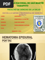 Signo de Mapache | PDF | Lesión | Medicina